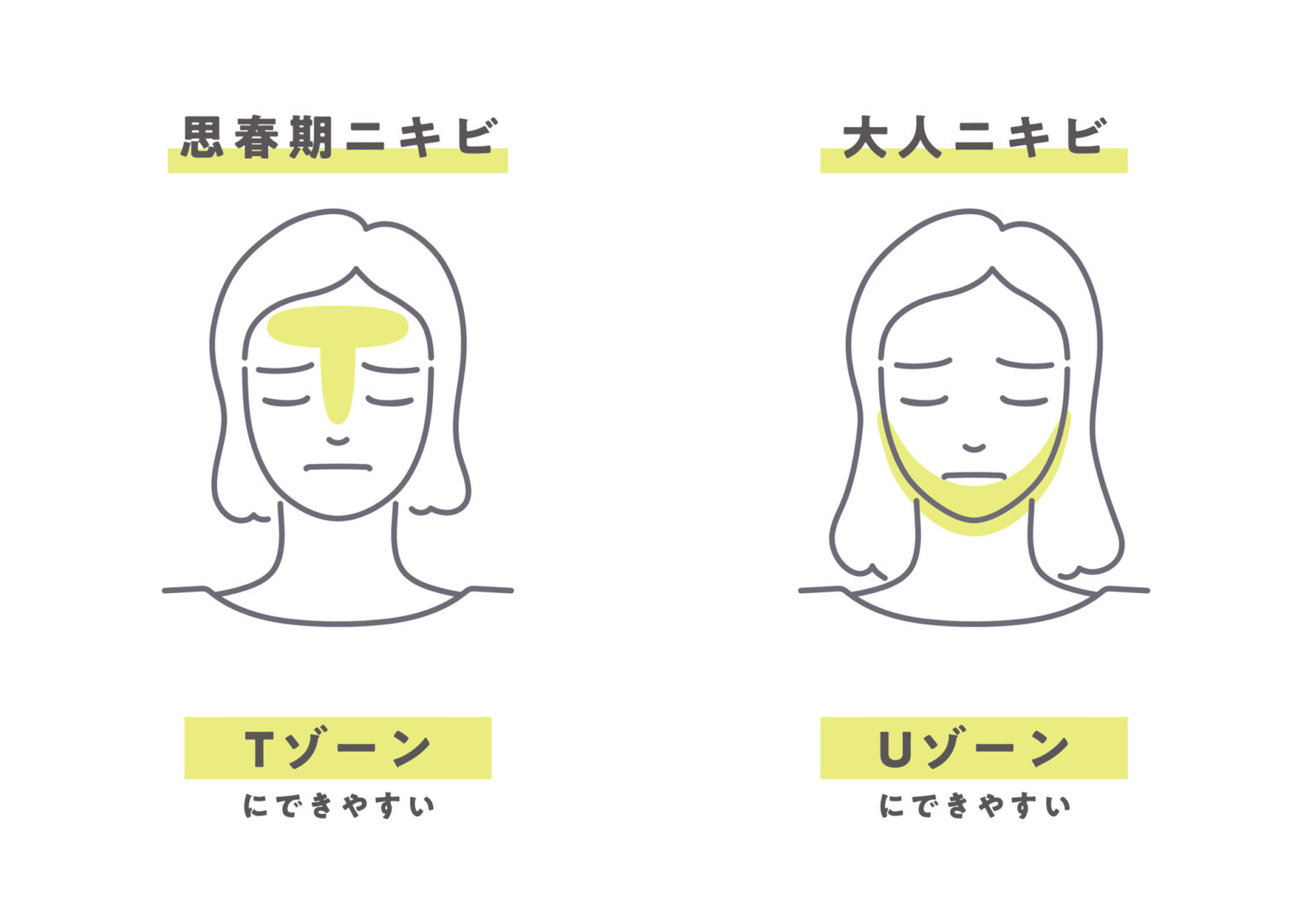 大人のニキビ肌におすすめの洗顔料と選び方！思春期ニキビとの違いや対策についても解説 – betop media